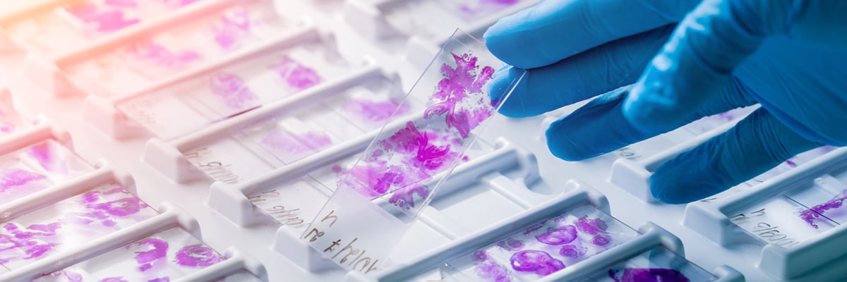 Histology Vs. Cytology