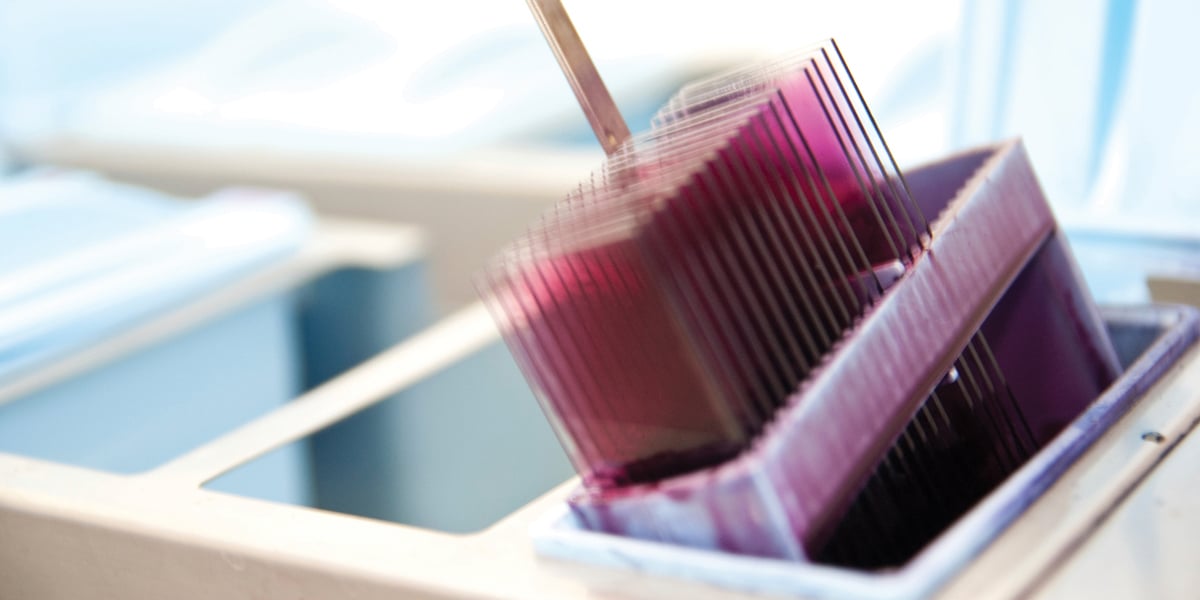 Hematology Differential Staining