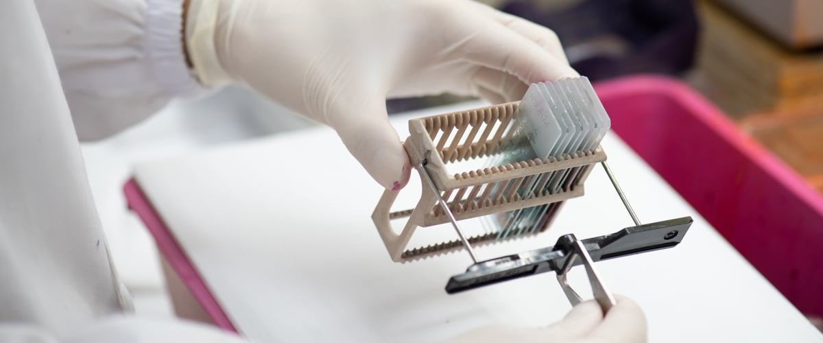 Hematology Differential Staining