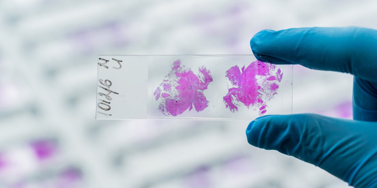 How to Choose the Right Cryostat