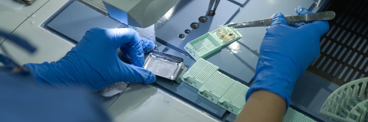 Microtome Blade Buying Guide