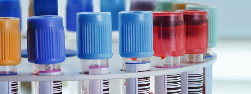 Blood Collection Tubes and the Role They Play in Modern Medicine